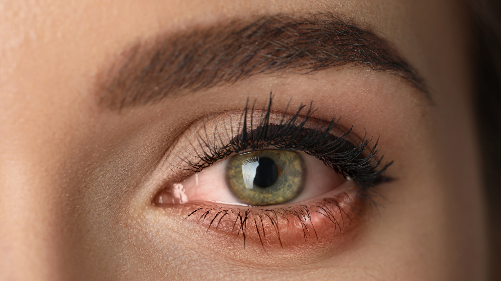 Eye Spy - Conjunctivitis - DeCare
